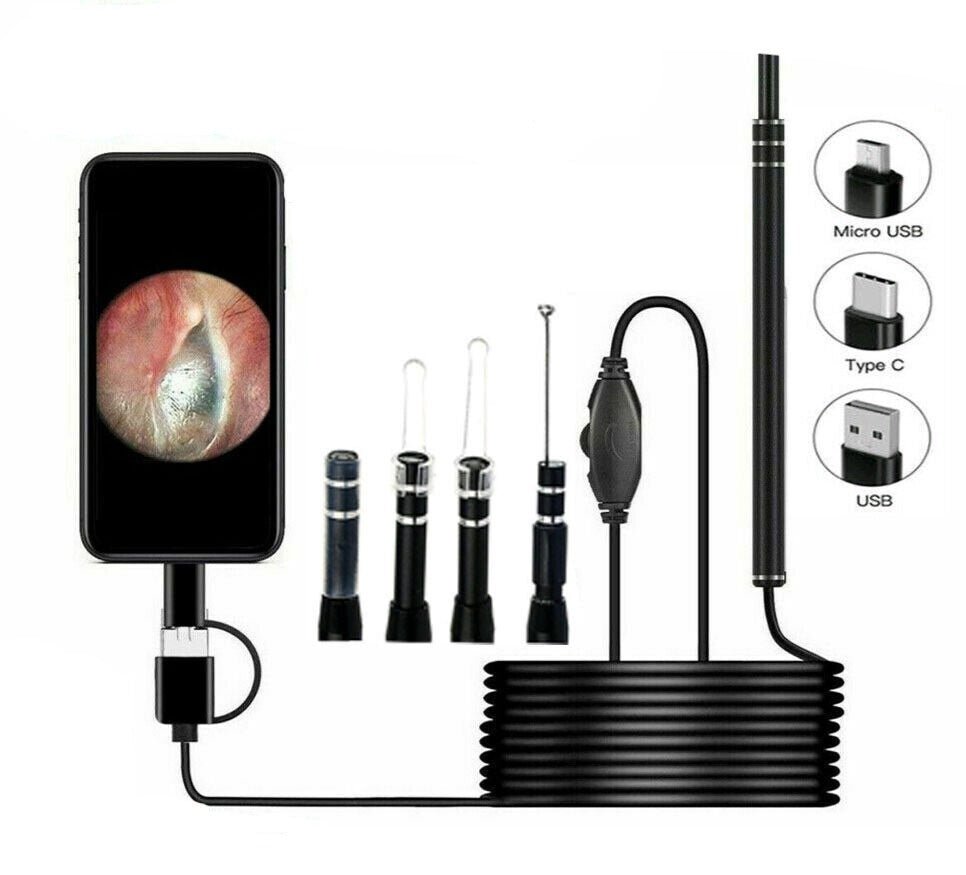 LED Ear Endoscope HD Otoscope Ear Wax Cleaning Camera – Gadfever